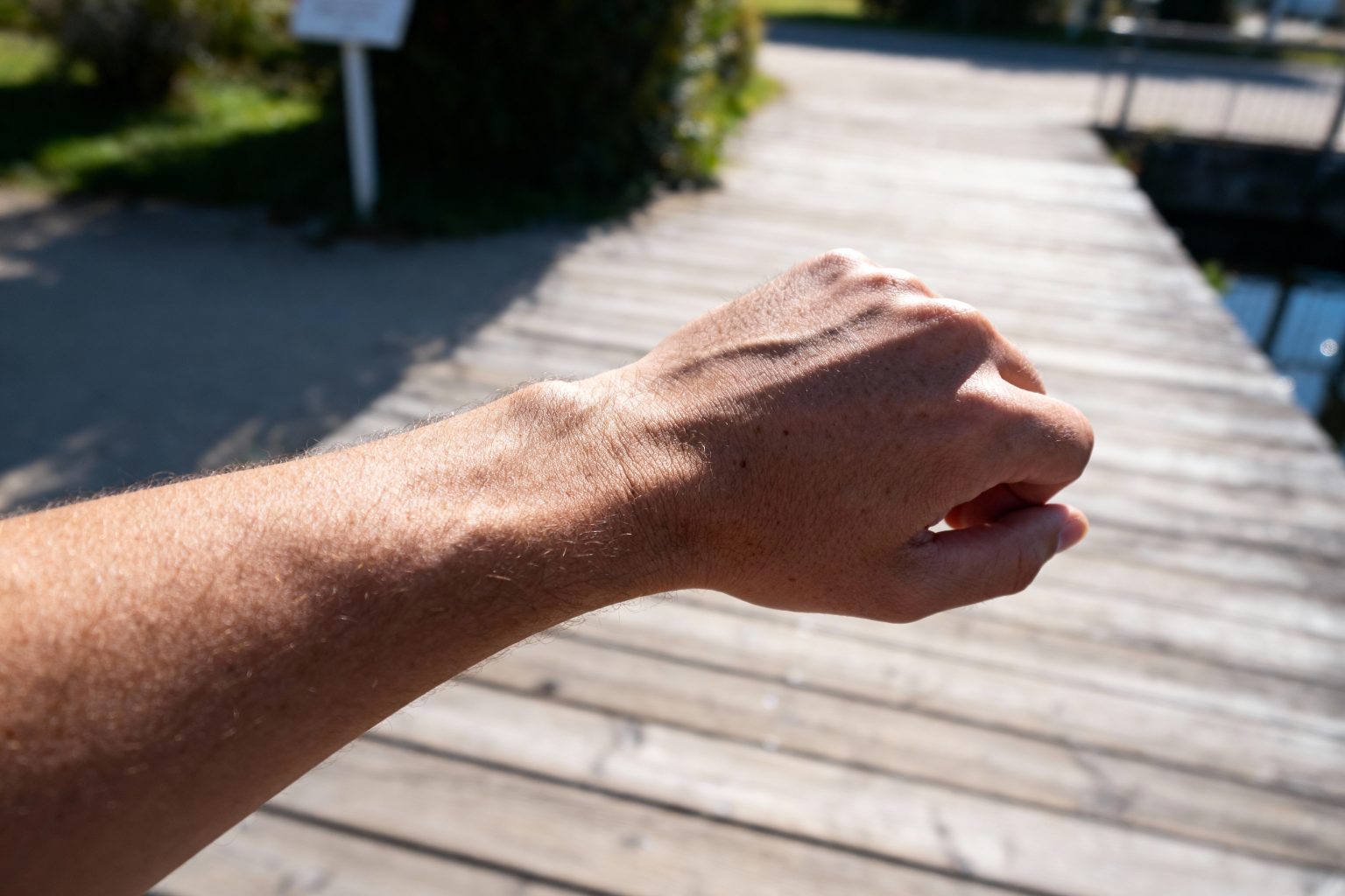 Ligaments du Poignet : Quelles Lésions et Symptômes ? 🖐️